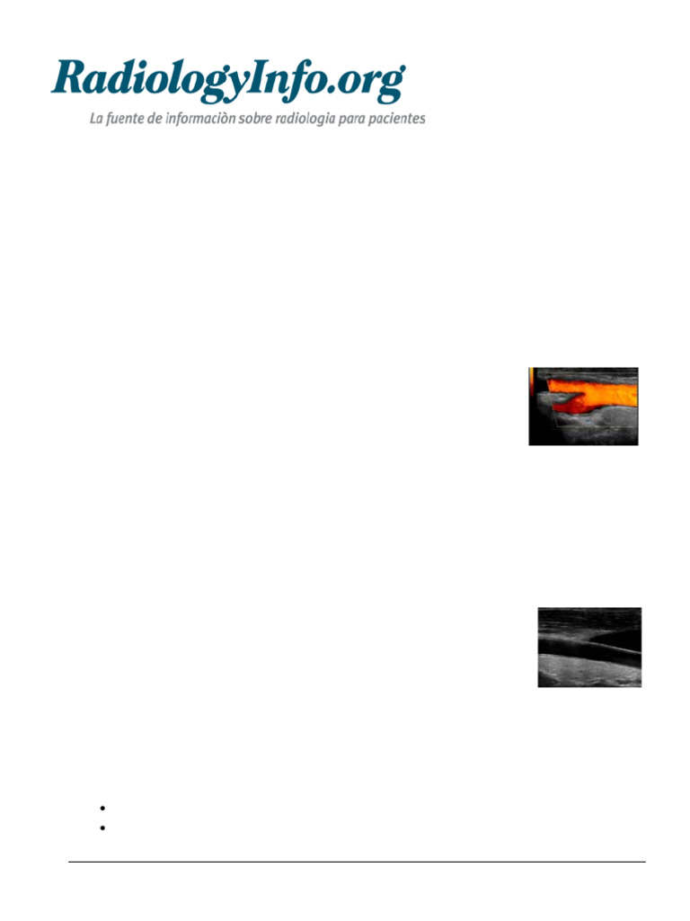 US_DOPPLER_CAROTIDEO | PDF | Ultrasonido | Ultrasonido médico