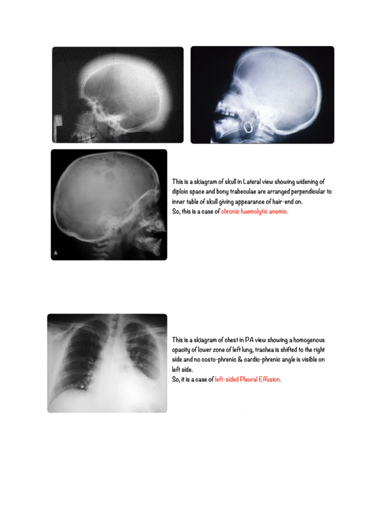 Paediatric x-ray | PDF | Thorax | Lung