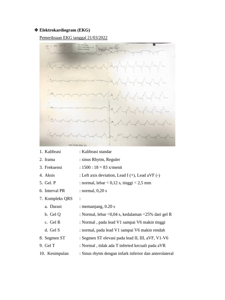 Elektrokardiogram KOAS IPD | PDF