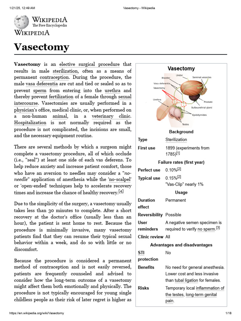 Vasectomy | PDF | Fertility | Human Reproduction