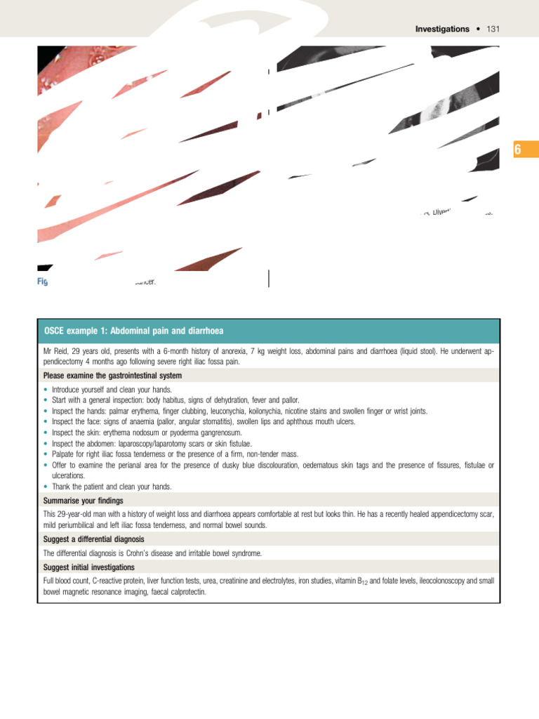 GIT Examination - ٠٩٠٩٥٨ | PDF | Abdomen | Crohn's Disease