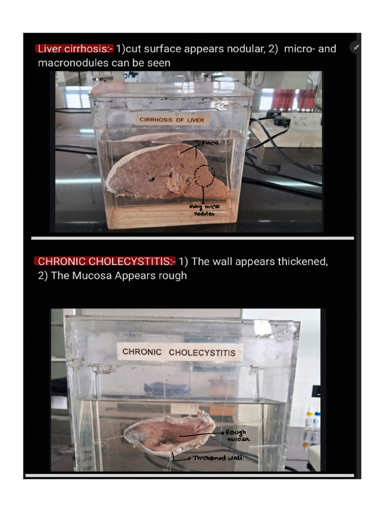 Pathology Gross Specimen | PDF
