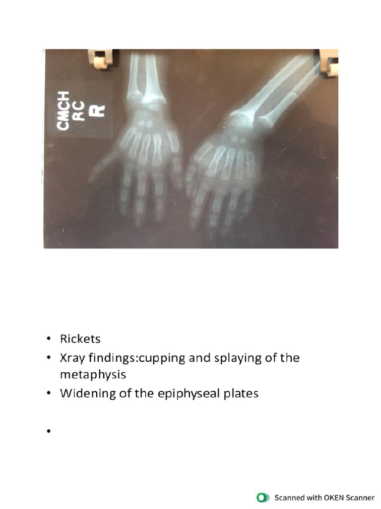 X Ray Extra | PDF