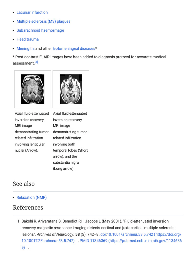 Fluid-Attenuated Inversion Recovery - Wikipedia | PDF