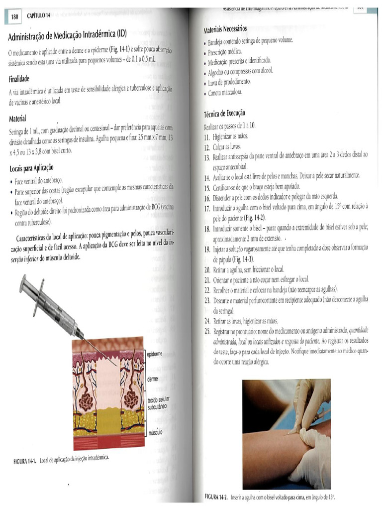 Fundamentos+Para+Prática+de+Enfermagem+ +Intradérmica+e+Subcutânea | PDF