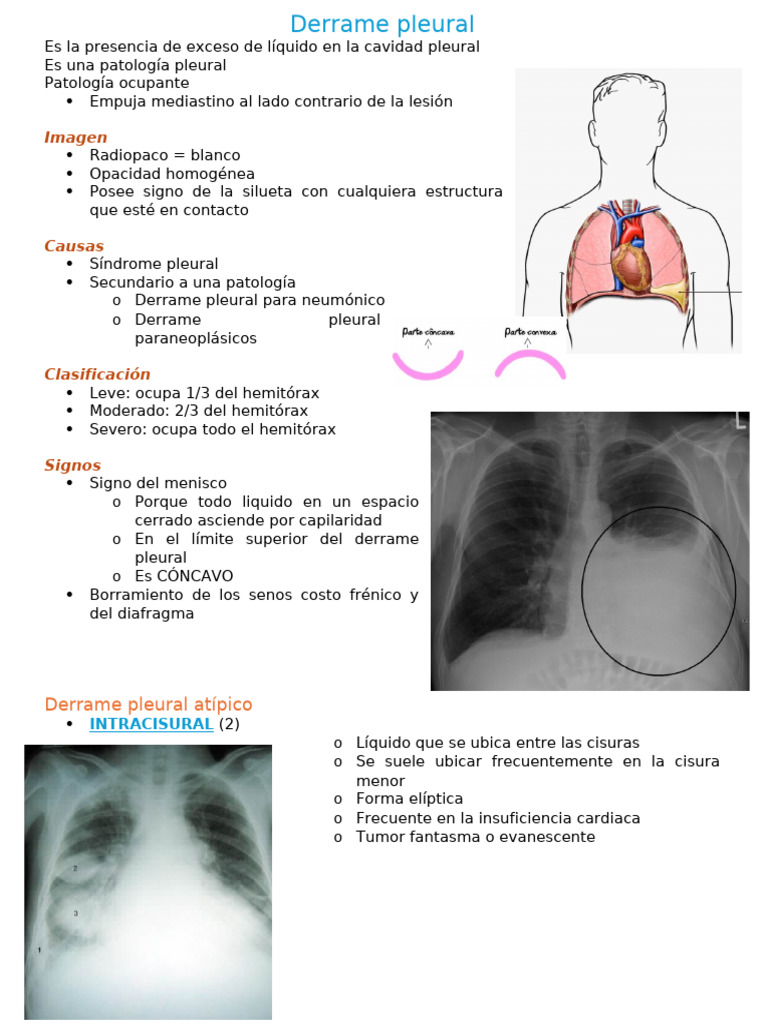 Derrame Pleural: Causas y Signos | PDF | Pulmón | Enfermedades y trastornos