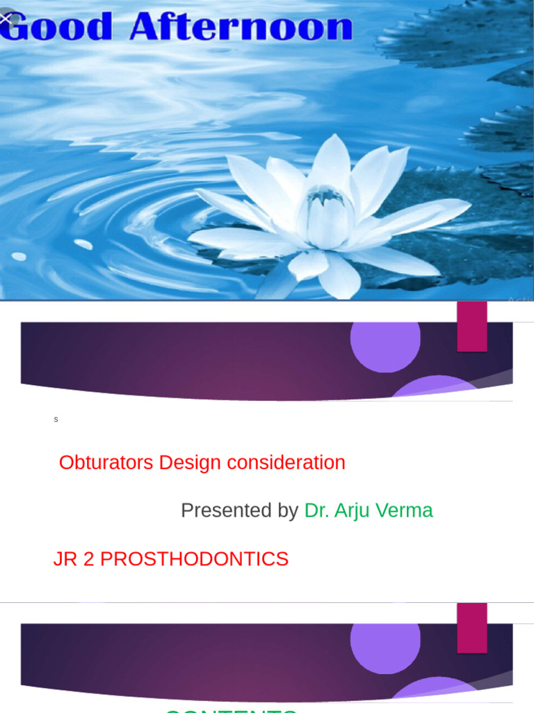 Obturator Design Considerations Guide | PDF | Dentistry Branches | Mouth