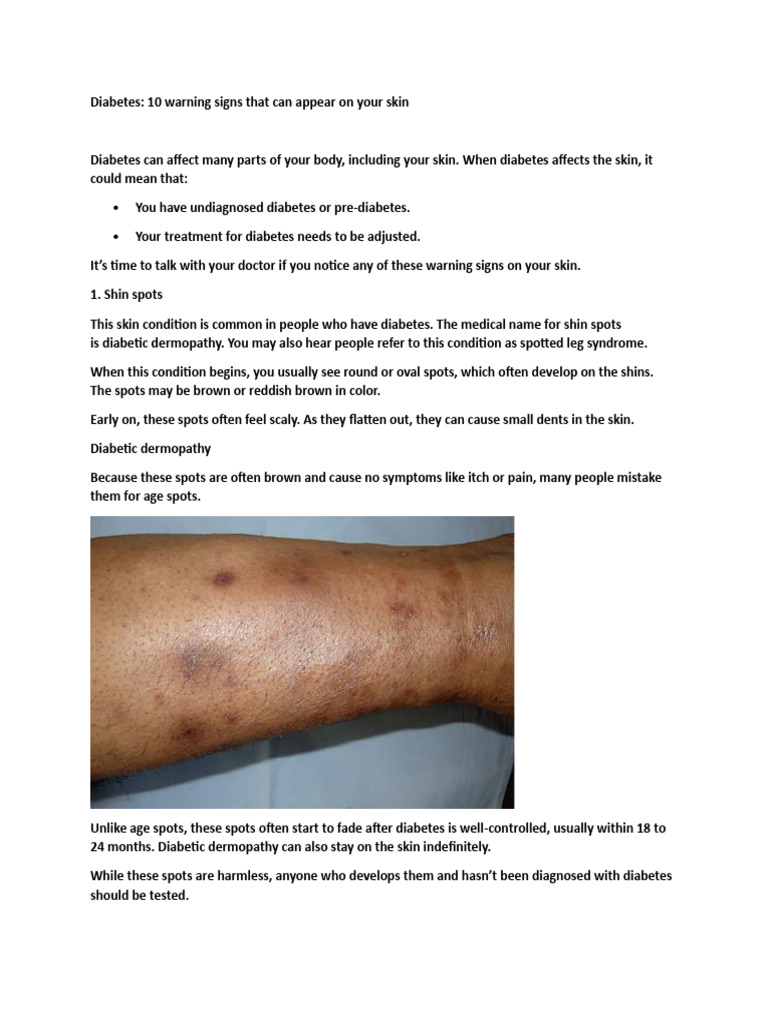 Diabetes-10 Warning Signs On Skin | PDF | Wound | Diabetes