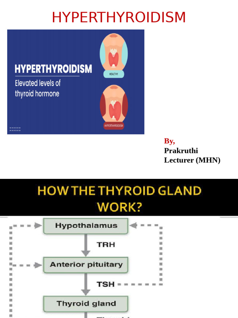 Hyperthyroidism | PDF