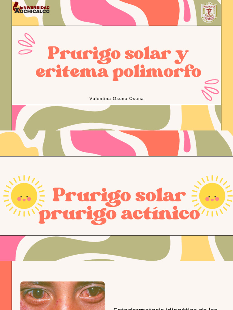Prurigo solar,eritema polimorfo-clinicas.pdf | PDF