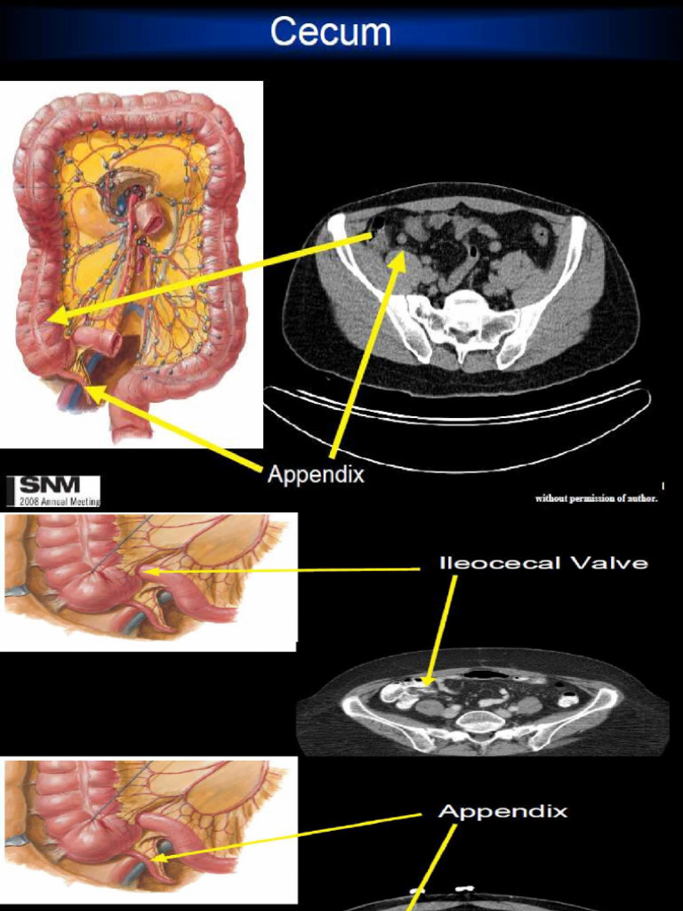 Additional GIT Radiology | PDF