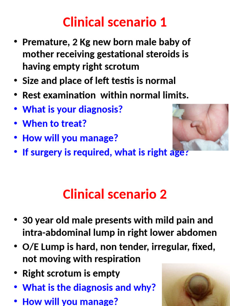 Undescended Testes: Diagnosis & Management | PDF | Testicle | Human ...