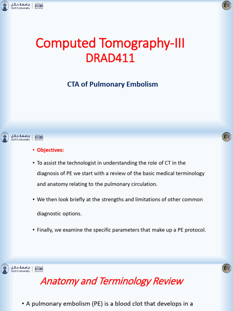 4- CTA of Pulmonary Embolism | PDF | Lung | Clinical Medicine