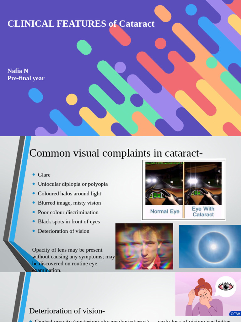 Cataract | PDF