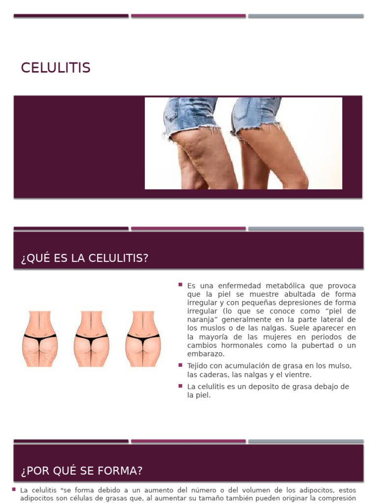 celulitis | PDF | Tejido adiposo | Frecuencia de radio