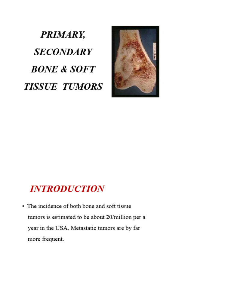 Bone & Soft Tissues Tumors 5th Fin.ppt | PDF | Metastasis | Sarcoma