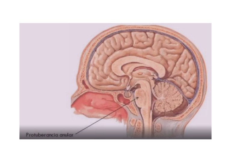 Protuberancia Anular | PDF