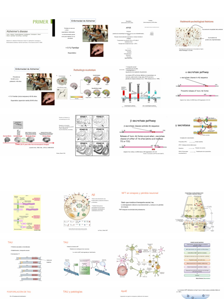 ALZH Vaia | PDF | Enfermedad de Alzheimer | Trastornos neurodegenerativos