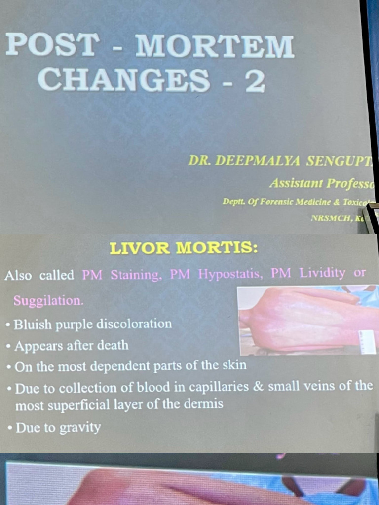 Post Mortem Changes 2, 30 Nov 2024 | PDF