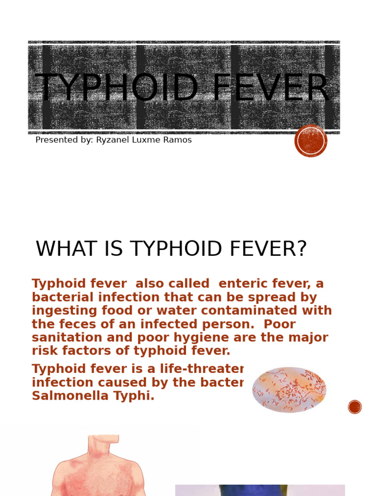Typhoid Fever | PDF