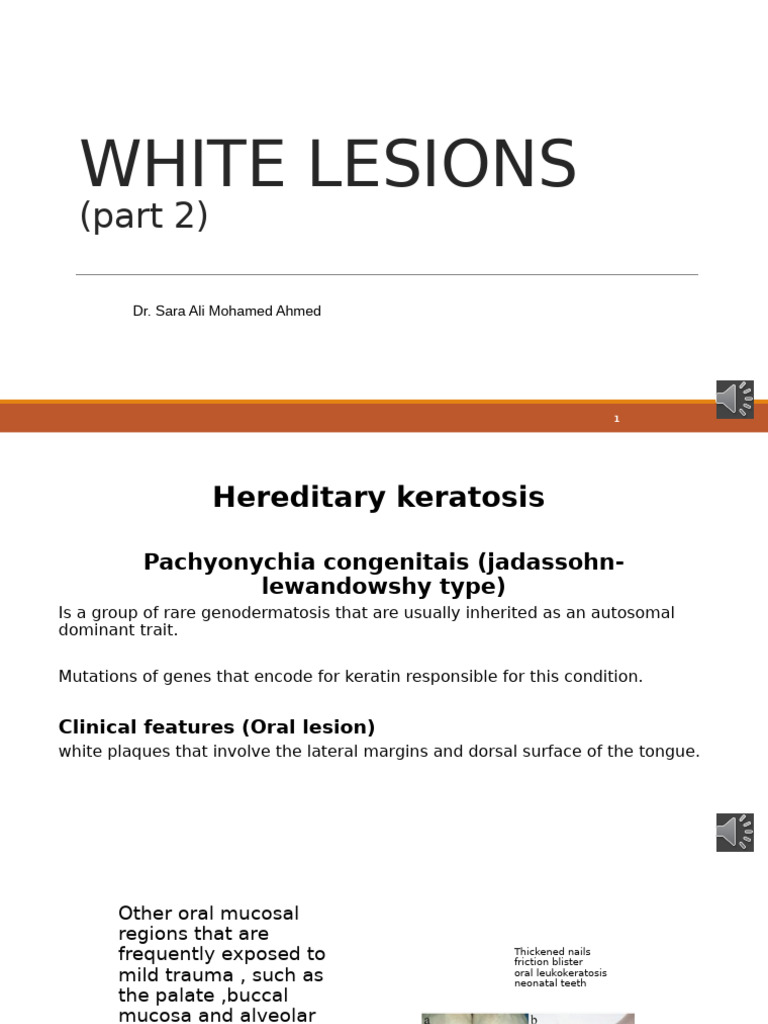 Oral White Lesions Guide | PDF | Medical Specialties | Diseases And ...