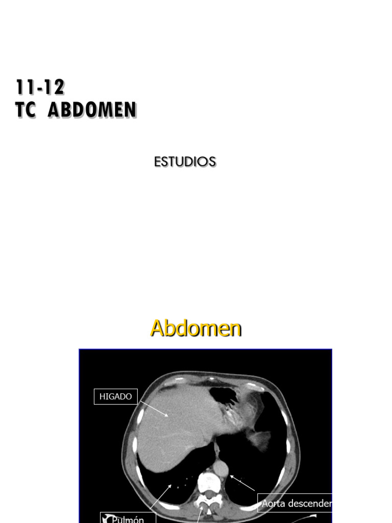 Estudio de Intestino Grueso en TC | PDF | Abdomen | Intestino grueso