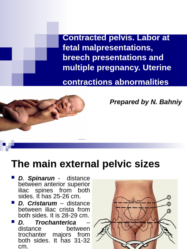 06_Contracted Pelvis. Labor at Fetal Malpresentations, Breech ...