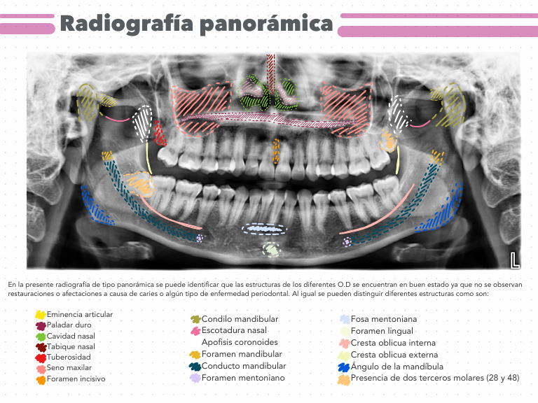 Estructuras en Radiografía Panorámica | PDF