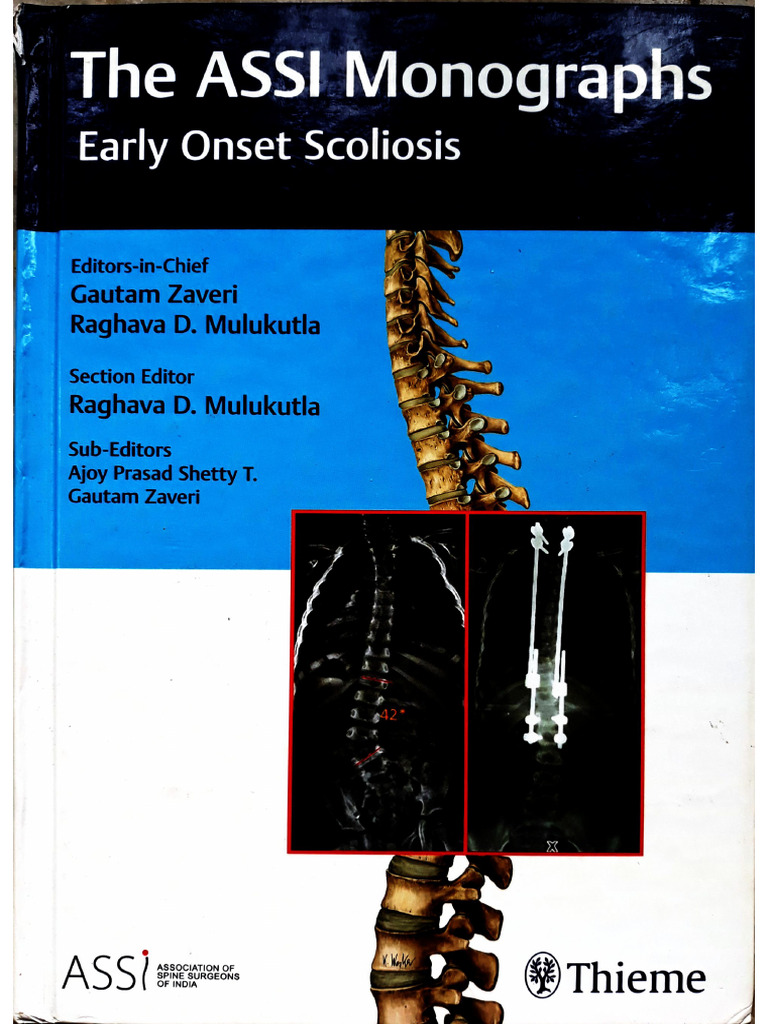 ASSI Early Onset Scoliosis MONOGRAPH | PDF