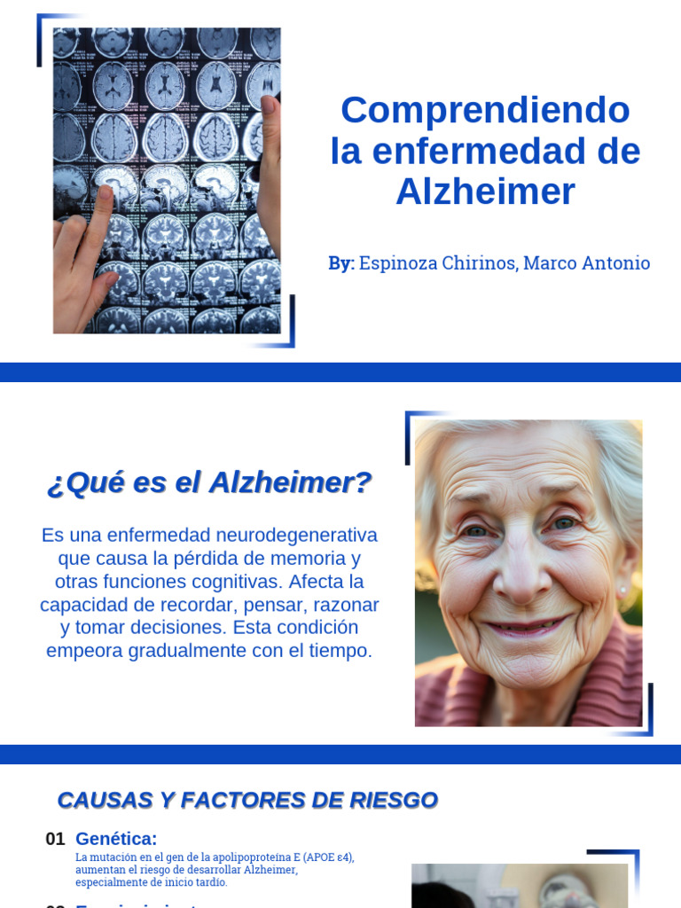 Guía Completa sobre el Alzheimer | PDF | Enfermedad de Alzheimer ...