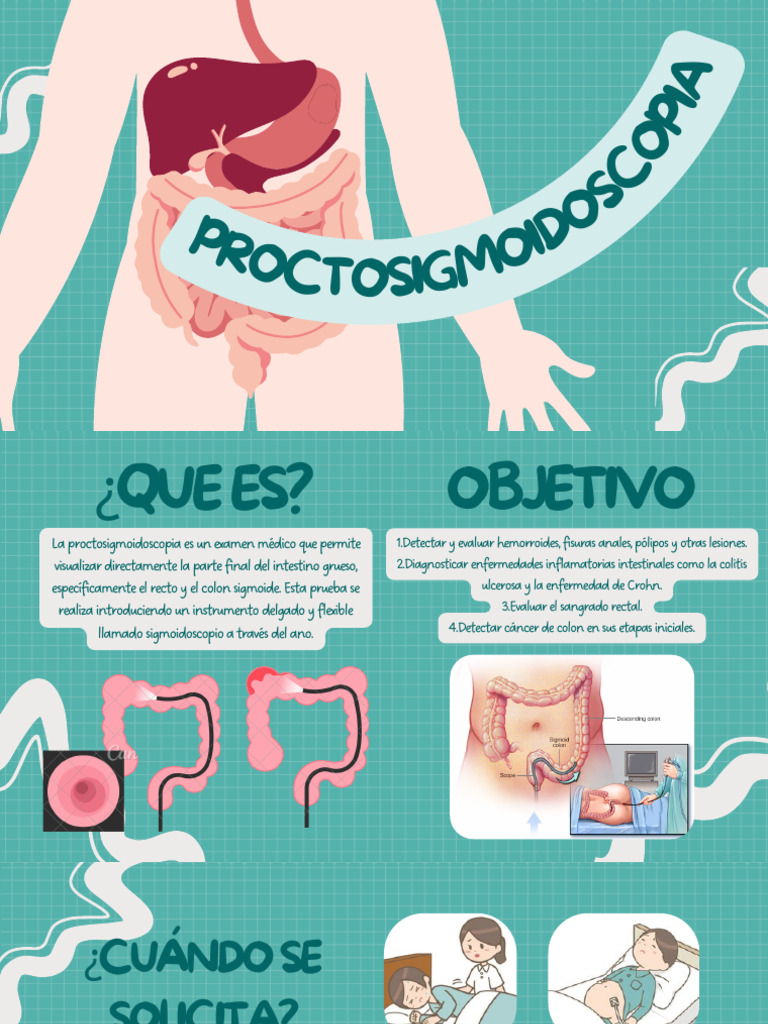 PROTOSIGMOIDOS | PDF | Cáncer colonrectal | Especialidades Medicas