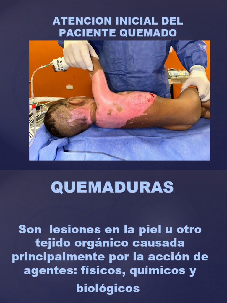 Atención Inicial del Paciente Quemado | PDF | Quemar | Piel