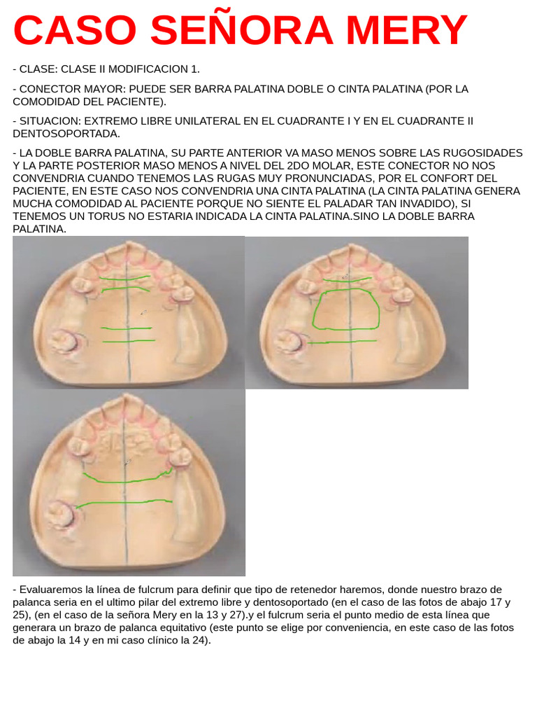 Caso Señora Mery | PDF