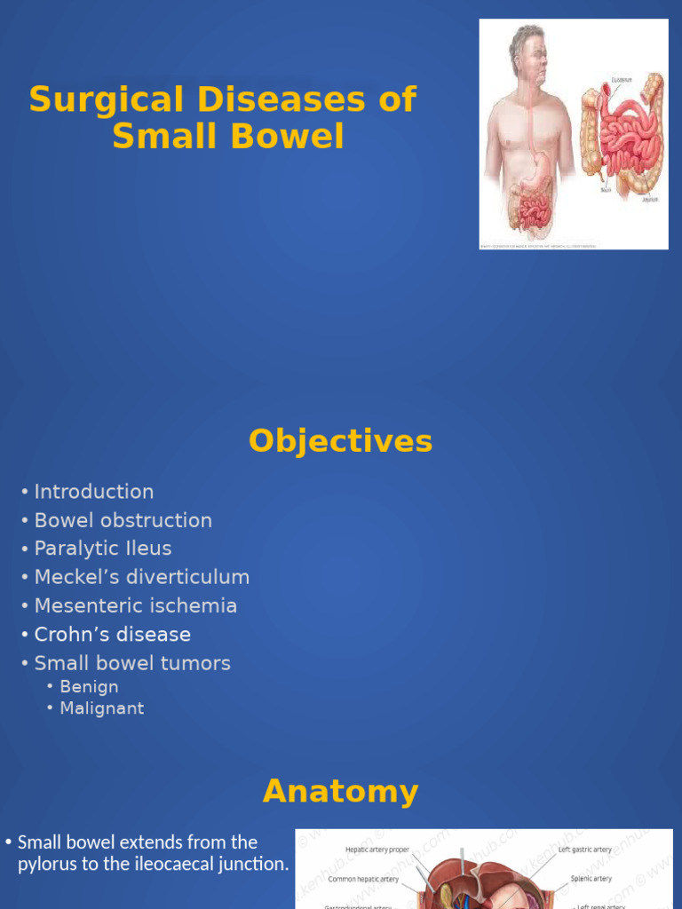 Small Bowel Surgical Diseases Overview | PDF | Small Intestine ...