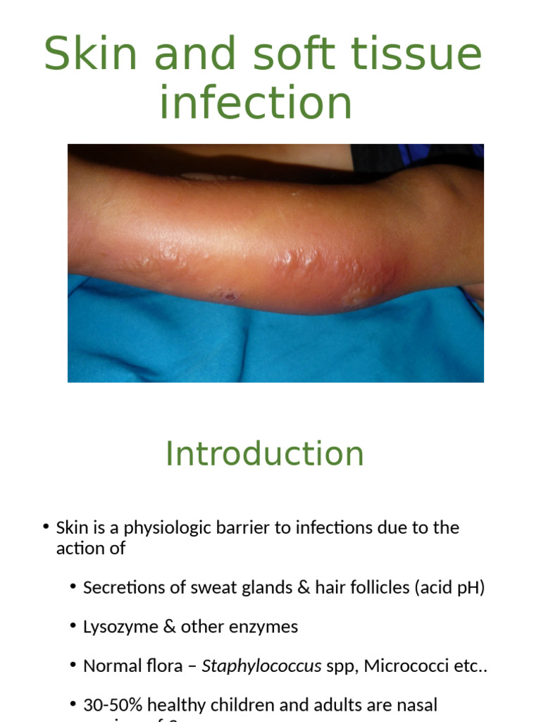 Skin and Soft Tissue Infections | PDF | Staphylococcus Aureus ...