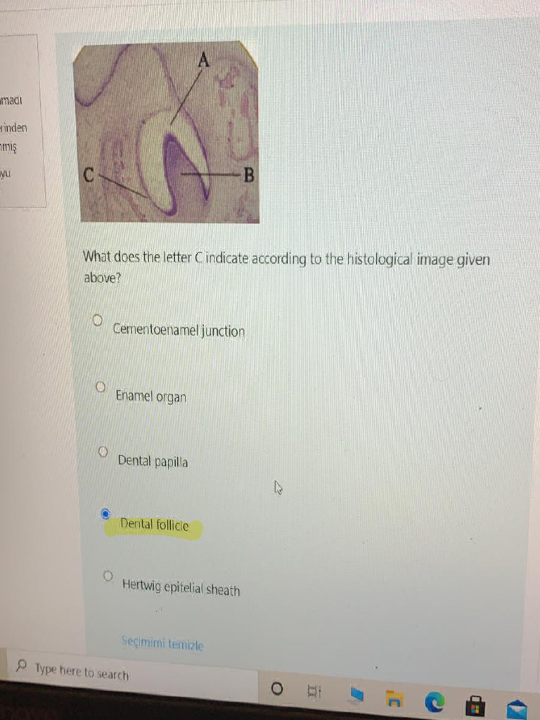 Endodontics Mid | PDF