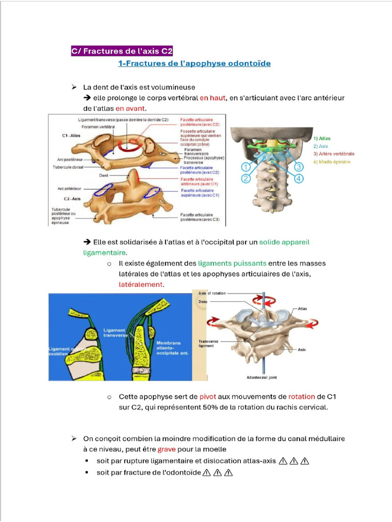 Fractures Rachis Axis C2 | PDF