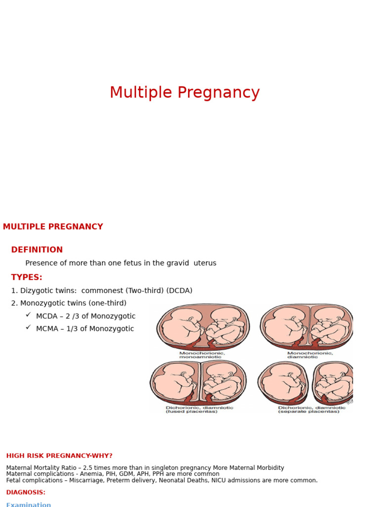 Multiple Pregnancy | PDF | Multiple Births | Pregnancy