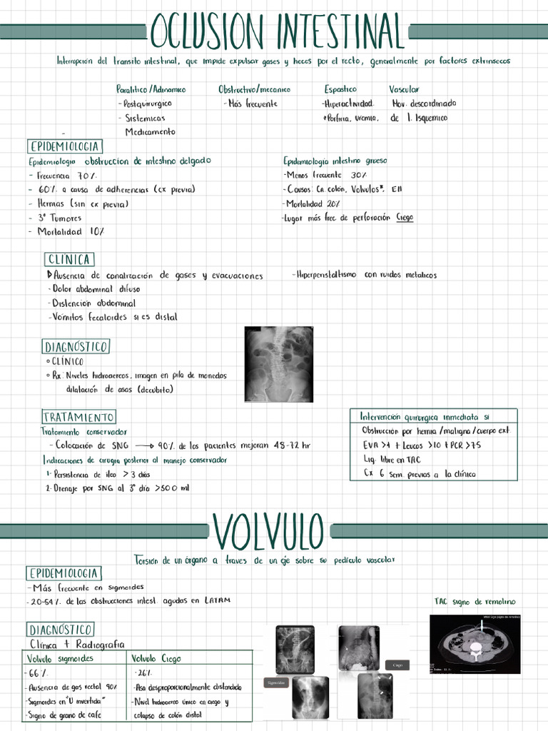 Oclusión Intestinal Volvulo Isquemia Intestina - 250107 - 195117 | PDF