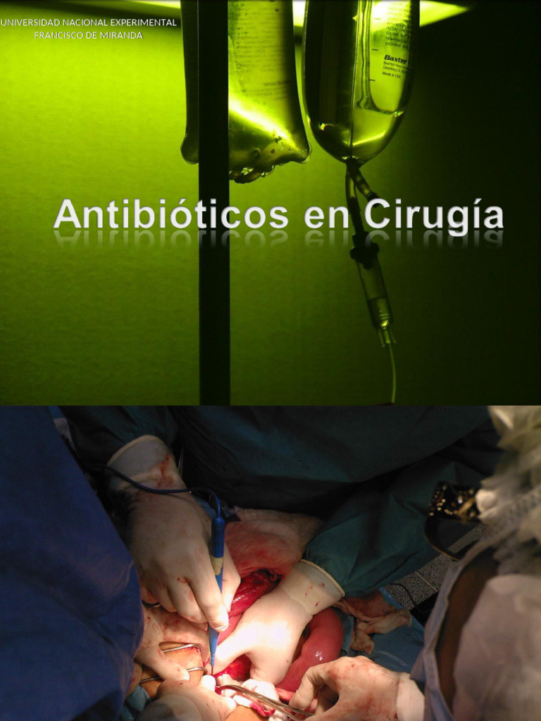3 Antibioticos en Cirugia-1 | PDF | Penicilina | Staphylococcus Aureus