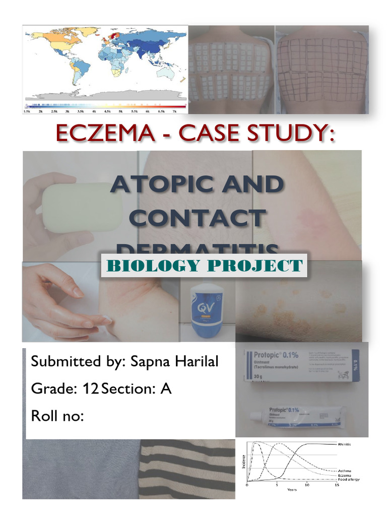 biology project | PDF | Dermatitis | Allergy