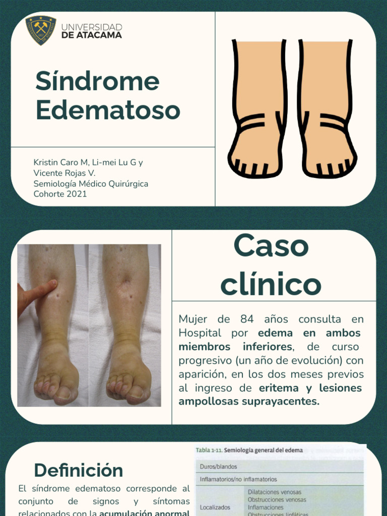 1.sindrome Edematoso | PDF | Edema | Medicina CLINICA