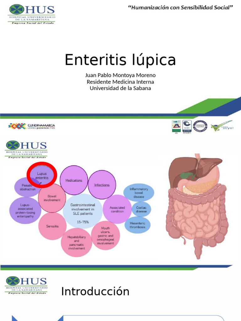 Enteritis lúpica | PDF | Especialidades Medicas | Enfermedades y trastornos