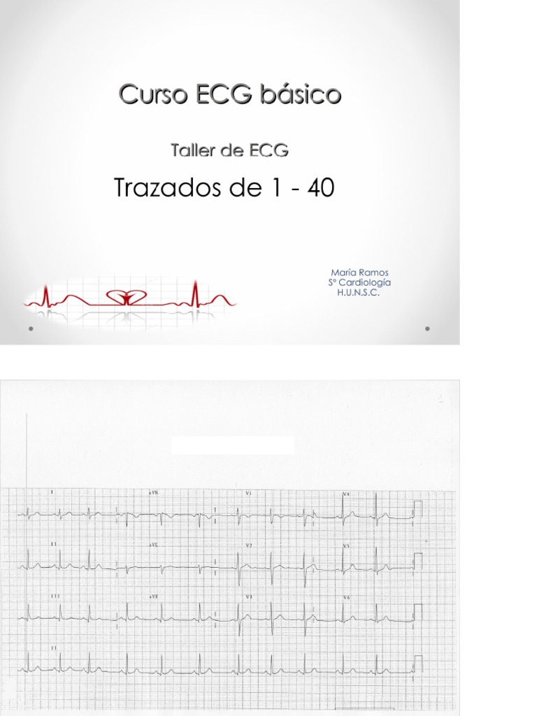 TRAZADOS Parte 1 ECG Basico ULTIMO | PDF