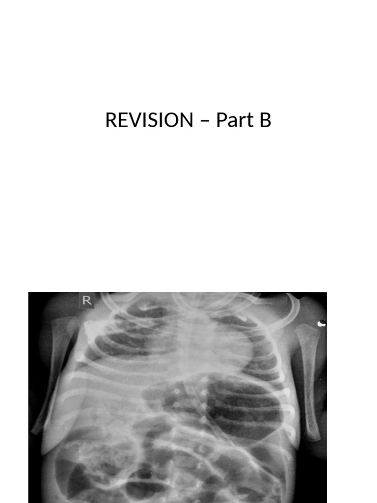 Revision - Extended - Part B | PDF