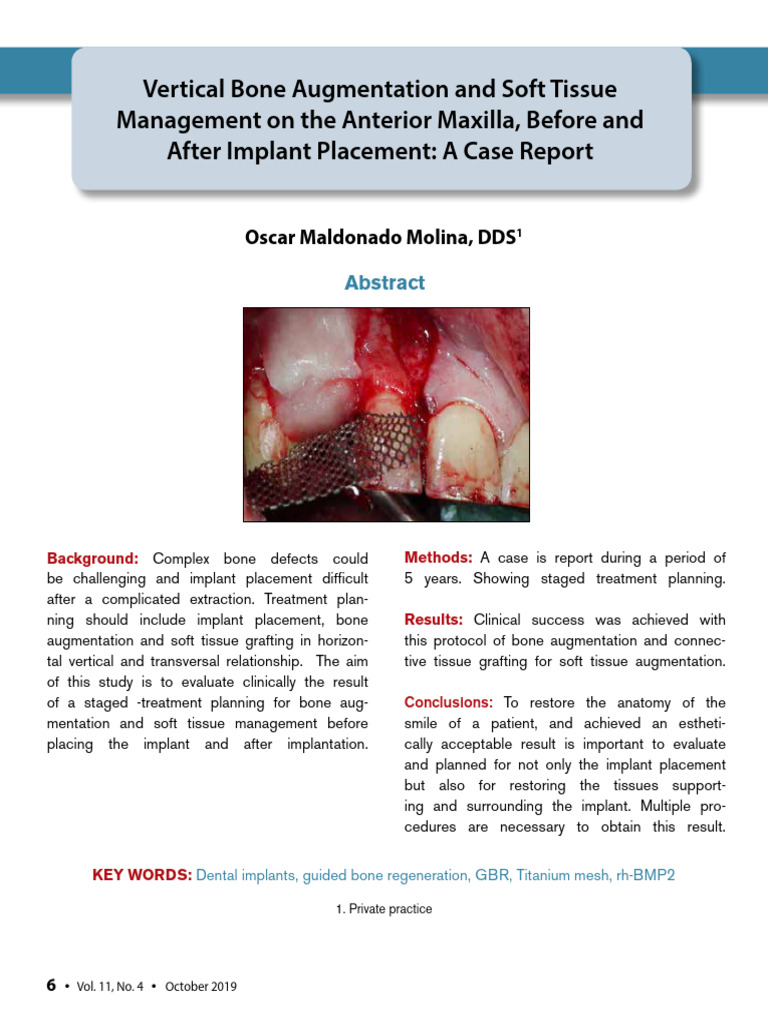 Vertical Bone Augmentation Case Study | PDF | Dental Implant | Medical ...