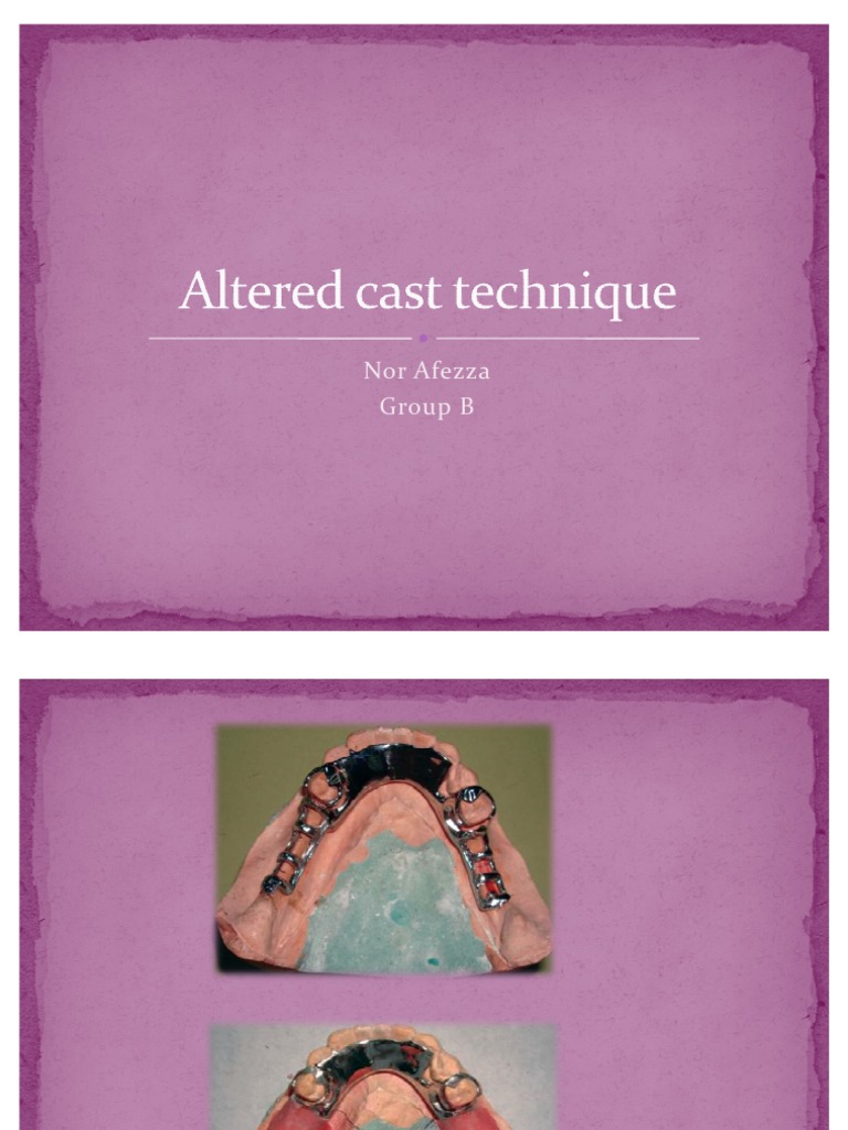 Altered Cast Technique | PDF