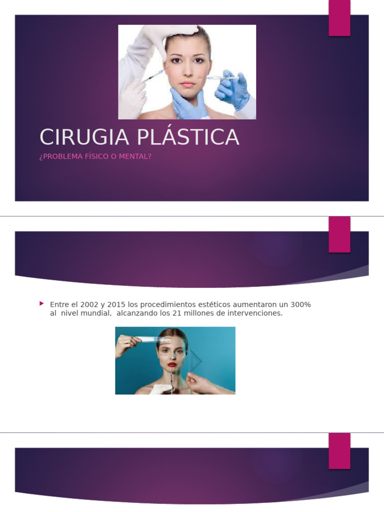 Presentación cirugia plastica | PDF