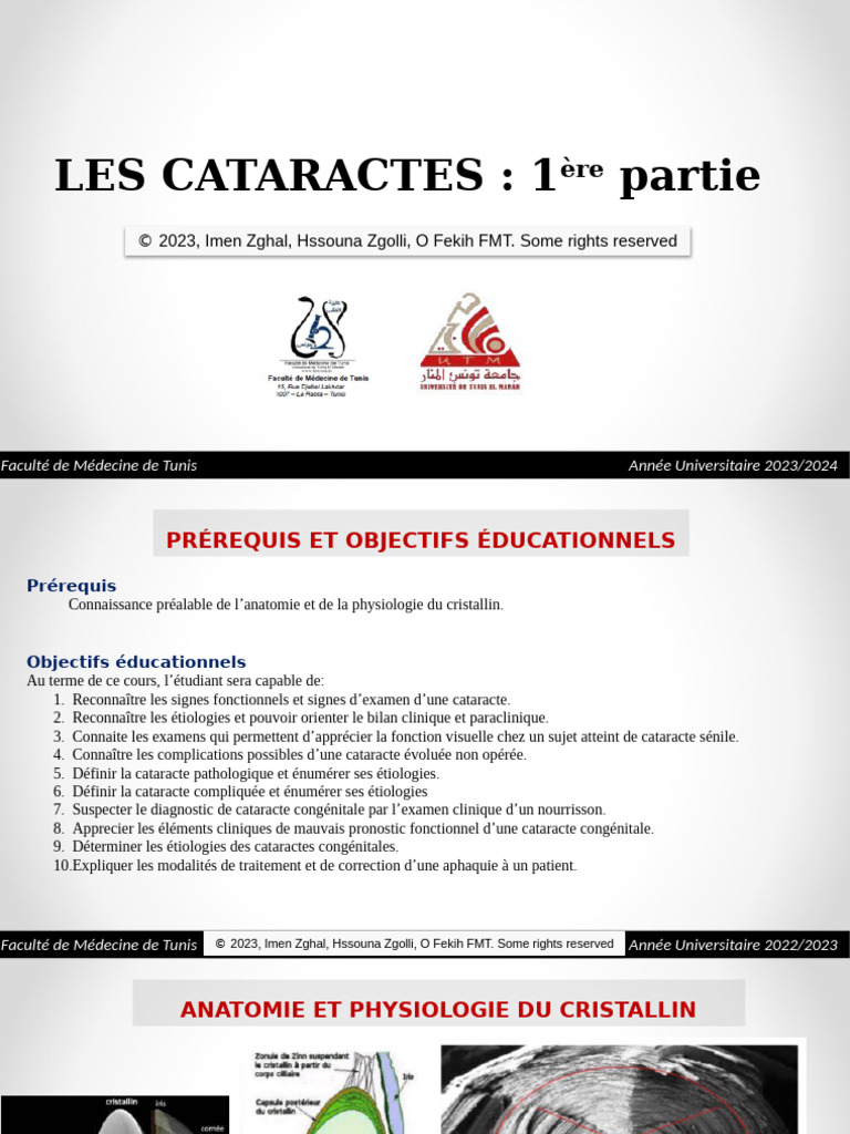 Comprendre les cataractes : définitions et types | PDF | Cataracte ...