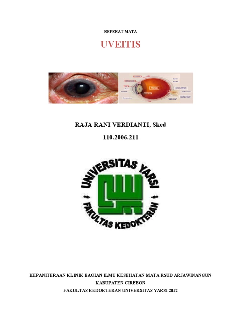 UVEITIS | PDF | Pengembangan Diri | Kesehatan Holistik